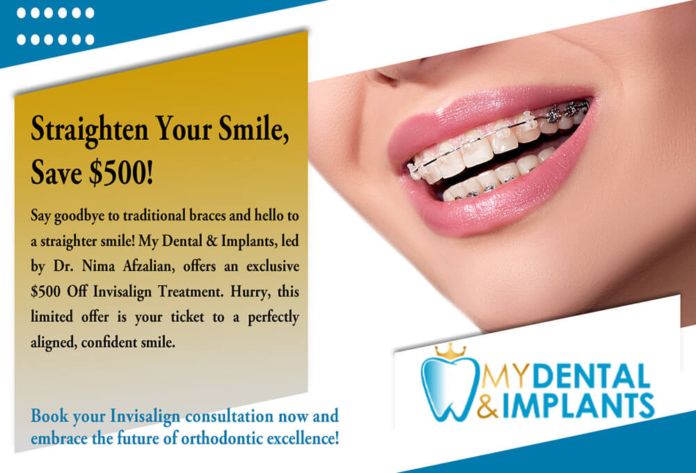 Dental Specials & Promotions Glendale | My Dental and Implants